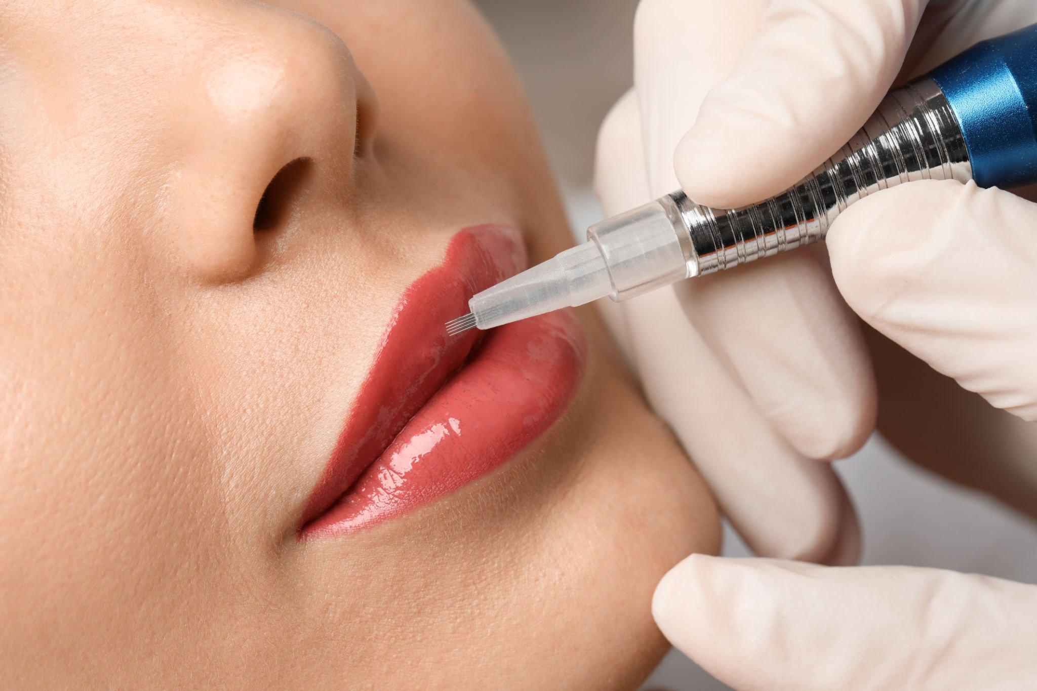 Lip Augmentation in Delhi at best price | Lip Filler