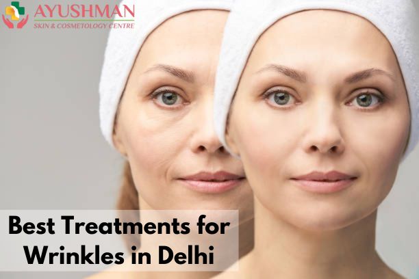 Best Treatments for Wrinkles in Delhi - Top Skin & Dermatologist ...
